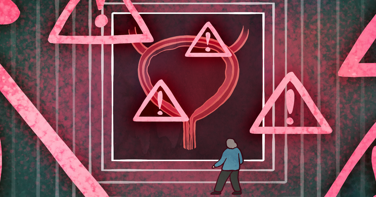 What is Bladder Cancer Recurrence and How is it Treated?