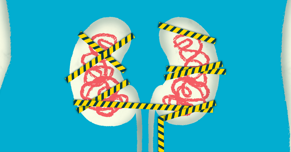 My First Urinary Diversion Before Bladder Removal: Nephrostomies