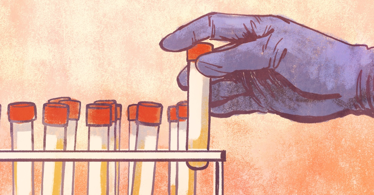 Bladder Cancer and the Urinary Microbiome